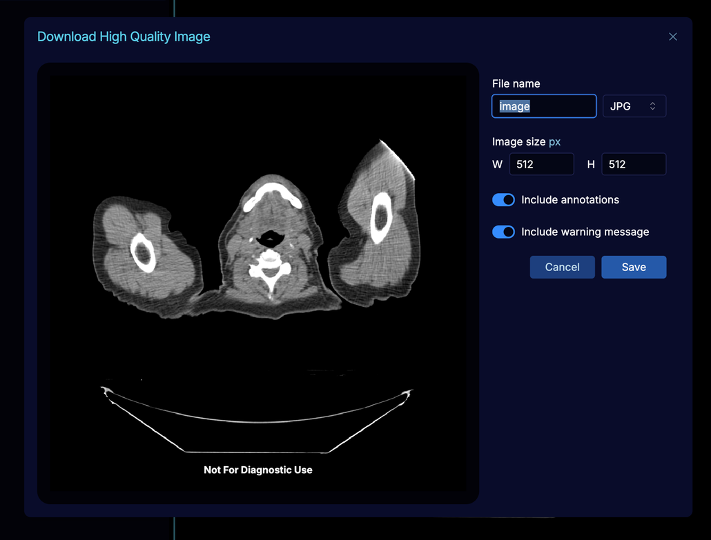 Customization Service | OHIF