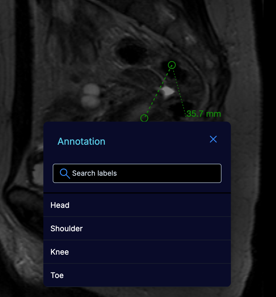 Customization Service | OHIF
